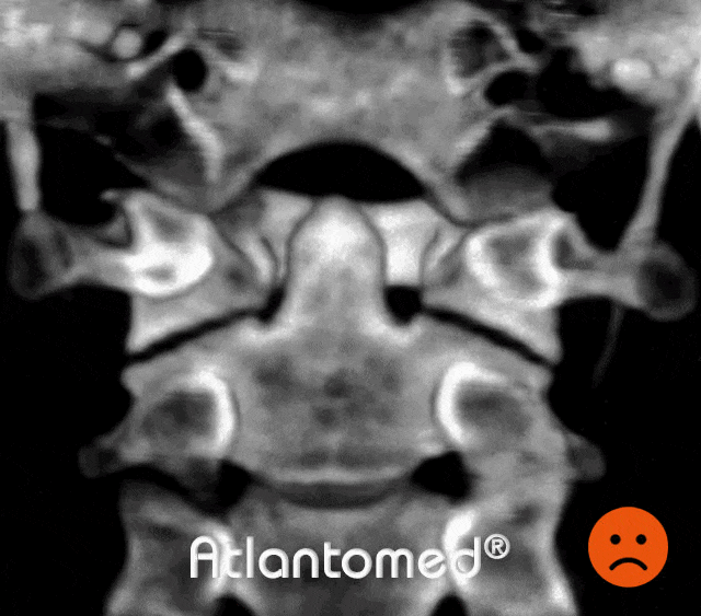 ATLASKORREKTUR: warum ist sie so wichtig? - ATLANTOMED